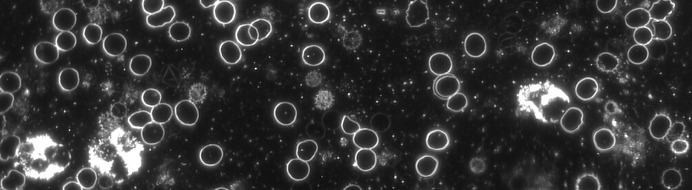 Biomedical Health Center Sonnenberg: Darkfield microscopy